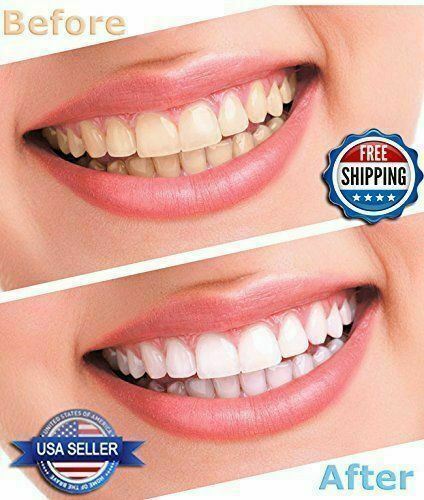 10 Pcs Thermoforming Tooth Bleach Dual Molding Mouth Trays Teeth ...