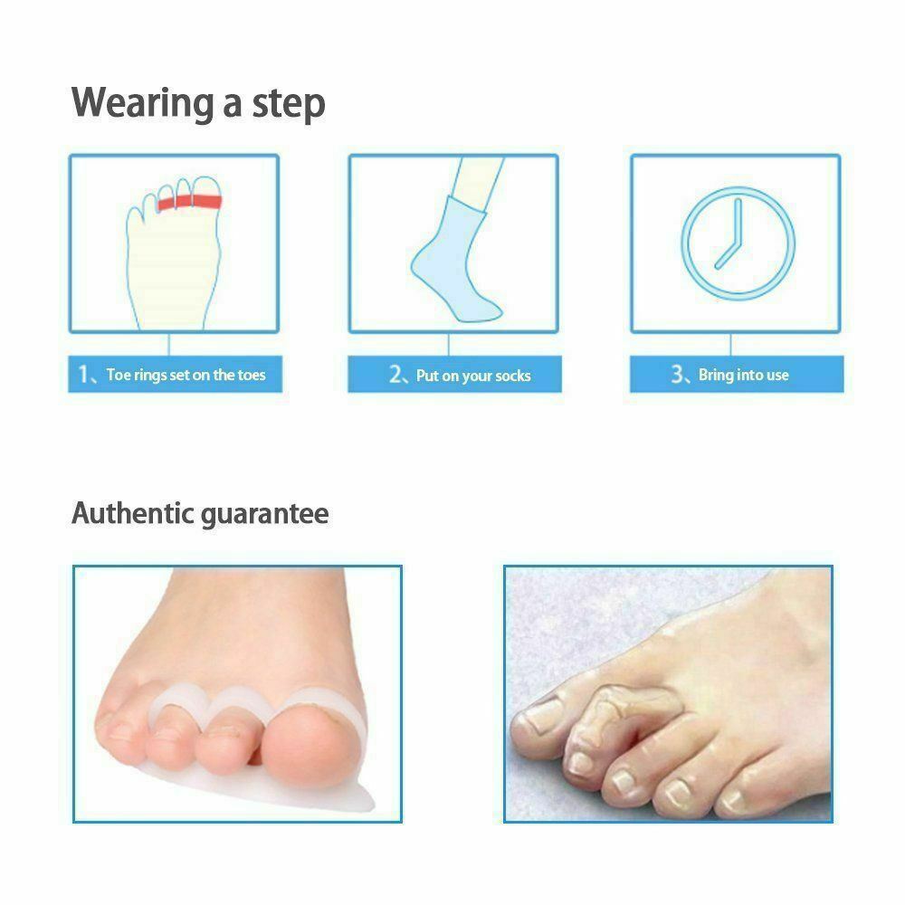 4 Pcs Toe Straightener Aid Pain Relief Hammer Claw Mallet Soft Gel Toe ...