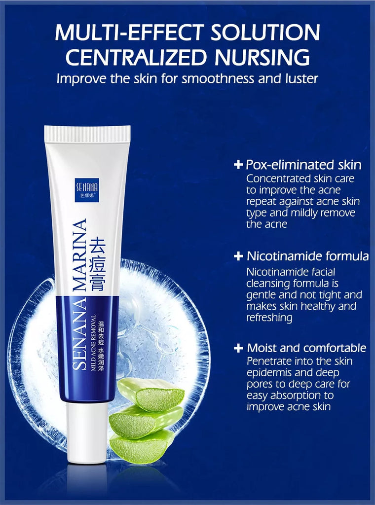 Acne Removal Nicotinamide Cream Aloe Vera Oil Control Shrink Pores ...